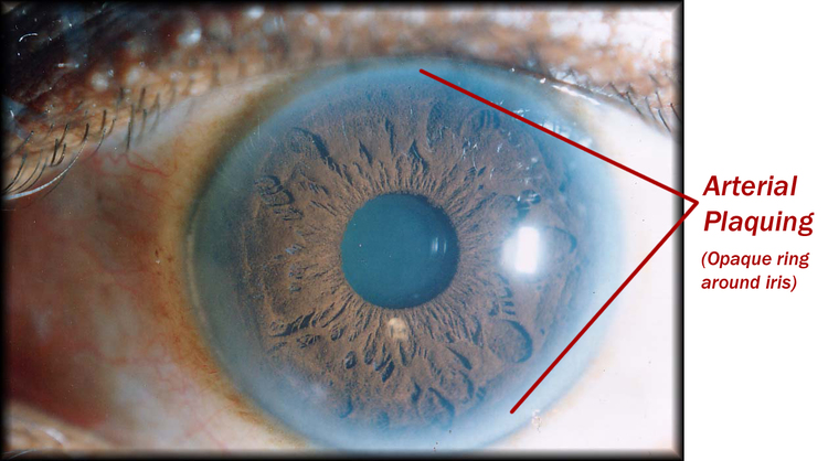 Iridology - Hossein Kord